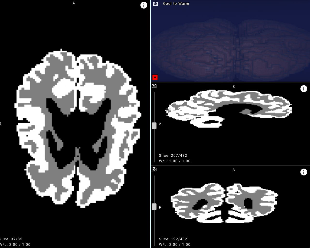 Russian Researchers Unveil First AI for Infant Brain MRI Analysis